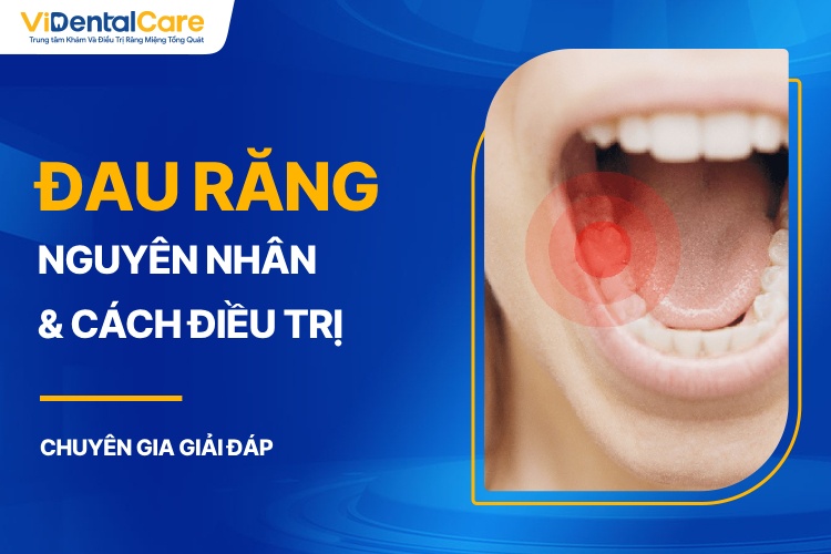 Đau Răng Do Đâu? Nguyên Nhân Và Cách Khắc Phục Hiệu Quả