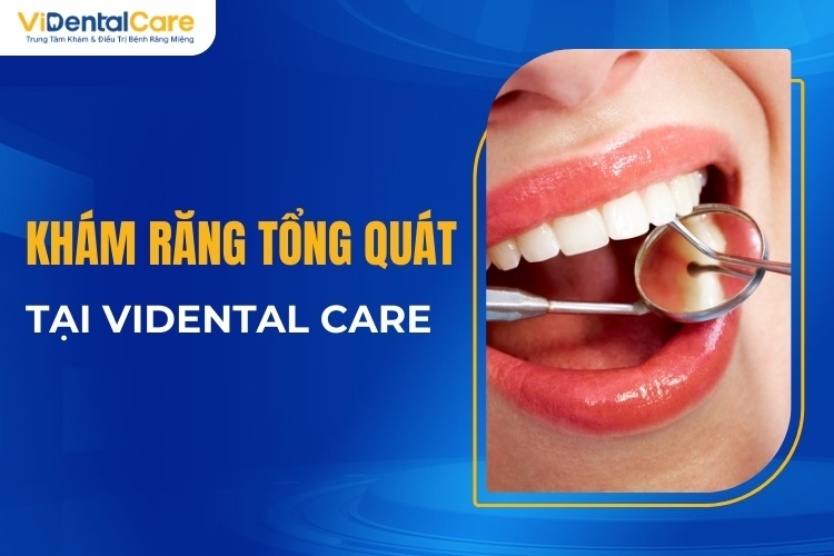 Khám Răng Tổng Quát Có Lợi Ích Gì? Những Thông Tin Cần Biết